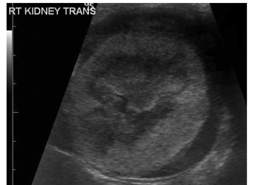 (PDF) Ultrasonography of the feline kidney: Technique, anatomy and ...