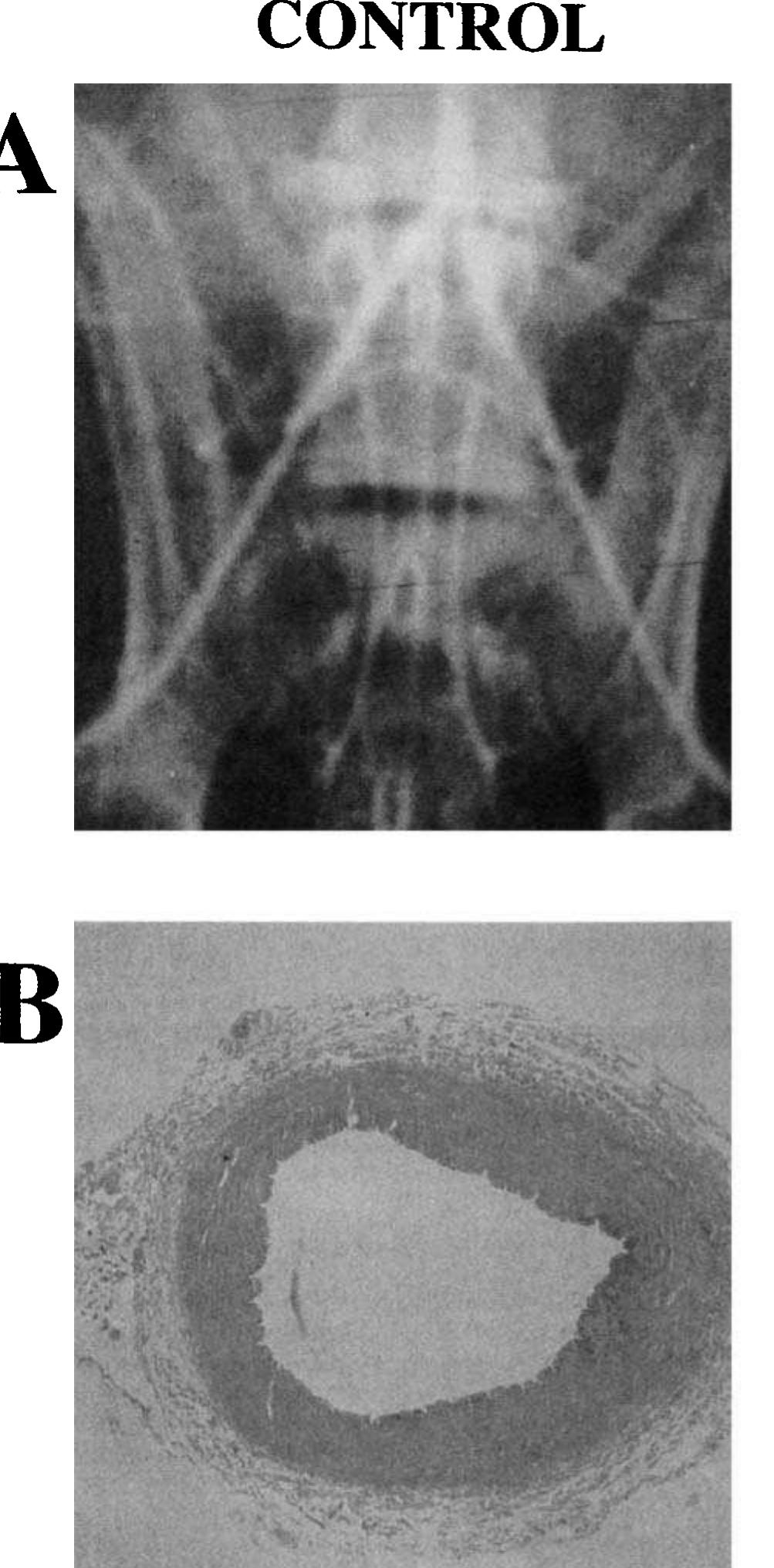 Fic. 1. a, arteriography and b, histology of iliac arteries