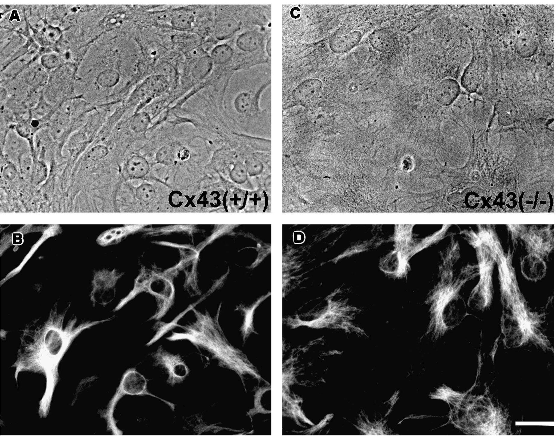 Morphology and gfap immunoreactivity in cultured astrocytes
