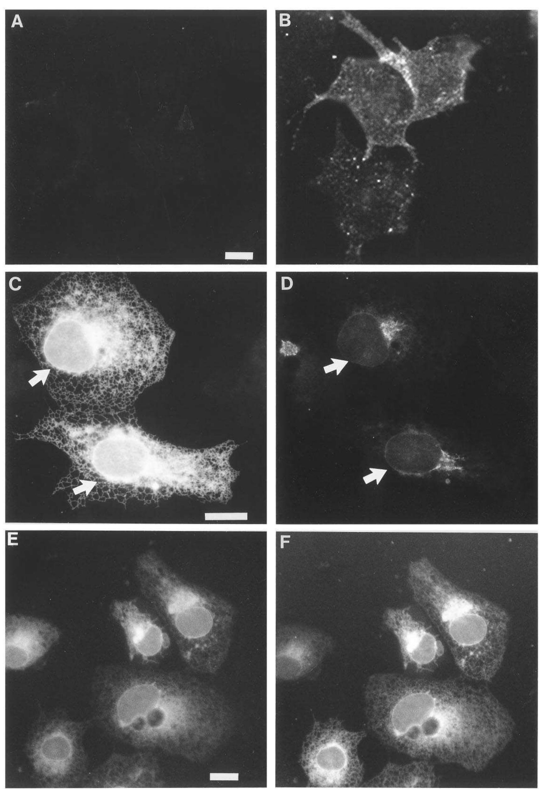 Immunofluorescent staining cos cells transfected with nrla,