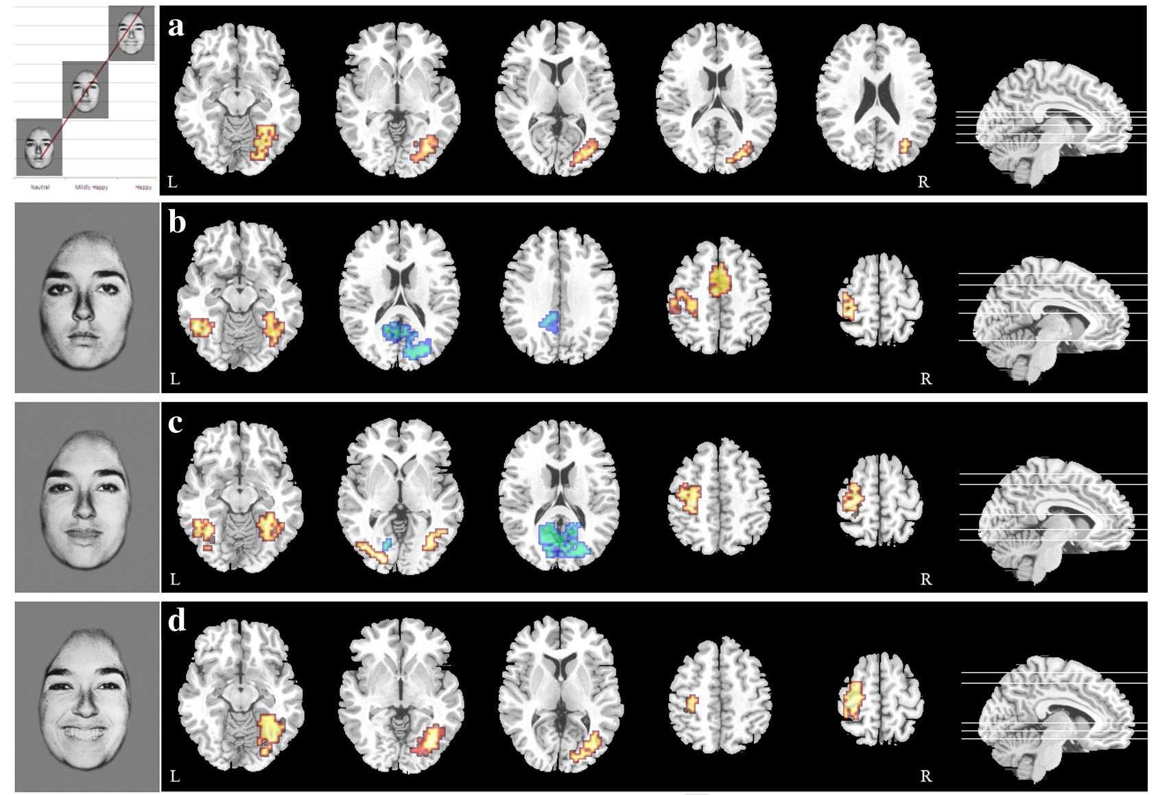 Differences in bold response on the i-fept for an (red) and