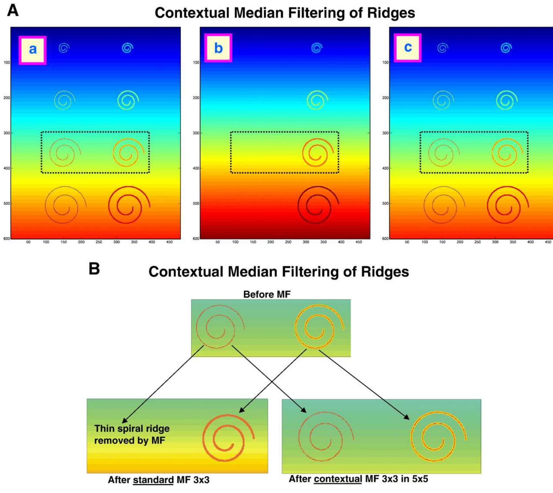 A. contextual median filtering of ridges. thin (1-pixel