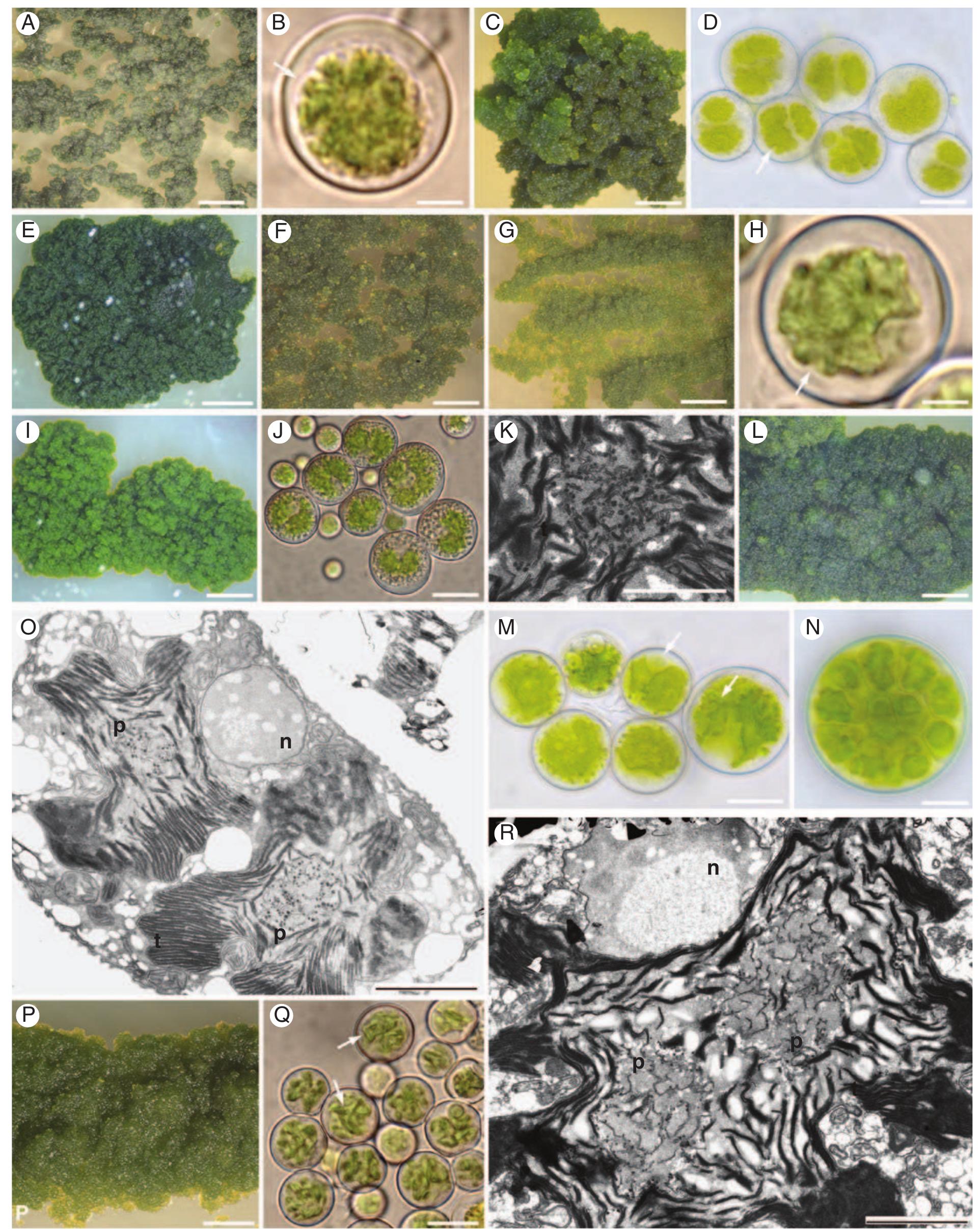 Fic. 4. morphology and anatomy of trebouxia species isolated
