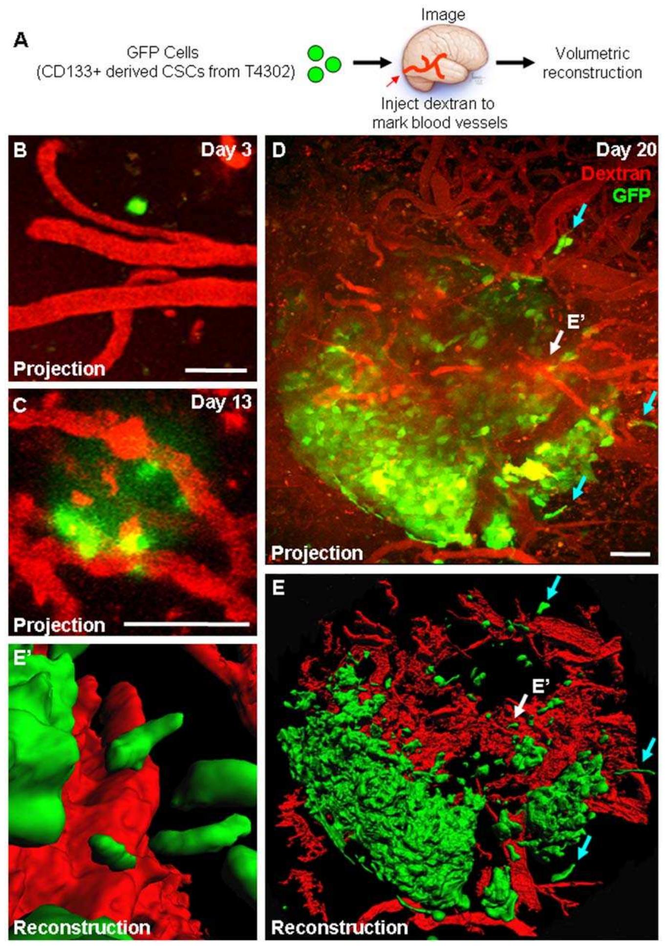 Multiphoton microscopy reveals tumor propagation from cancer