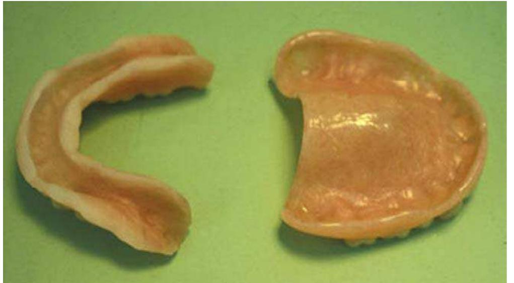 Intaglio surfaces of maxillary and mandibular immediate