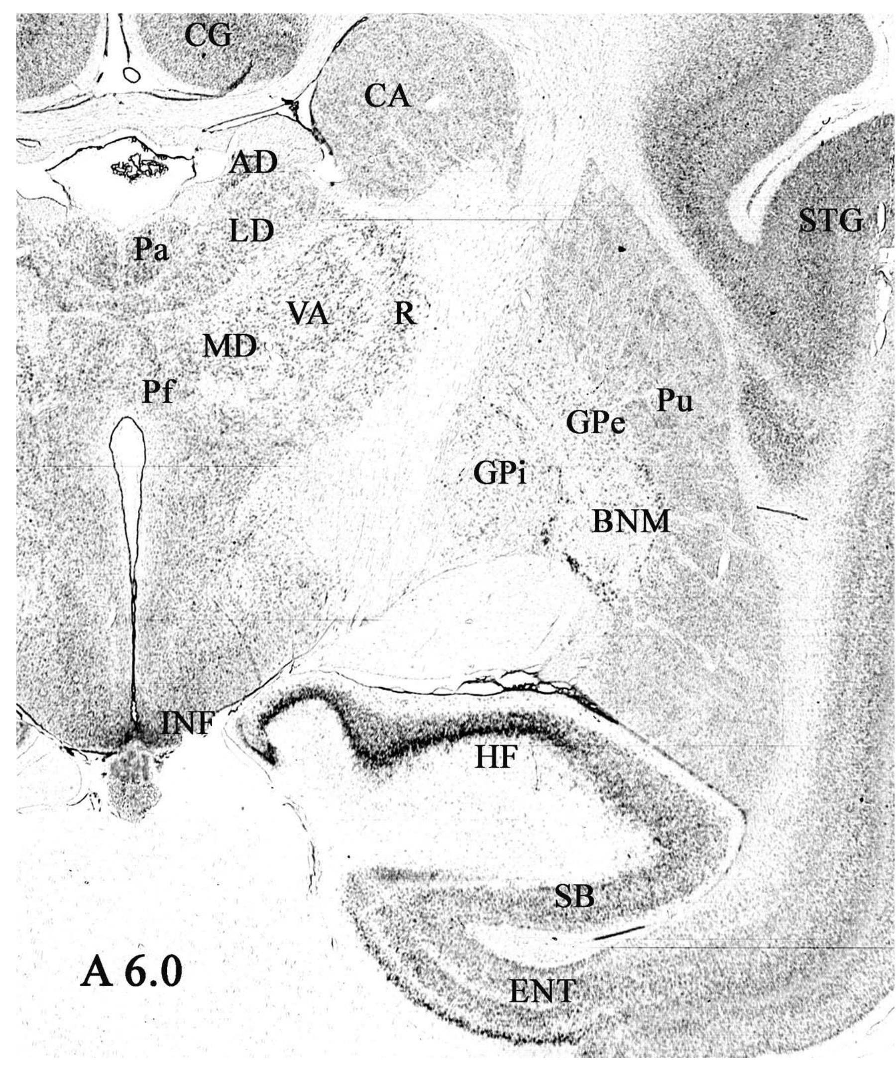 Figure 15 - from A combined histological and MRI brain atlas