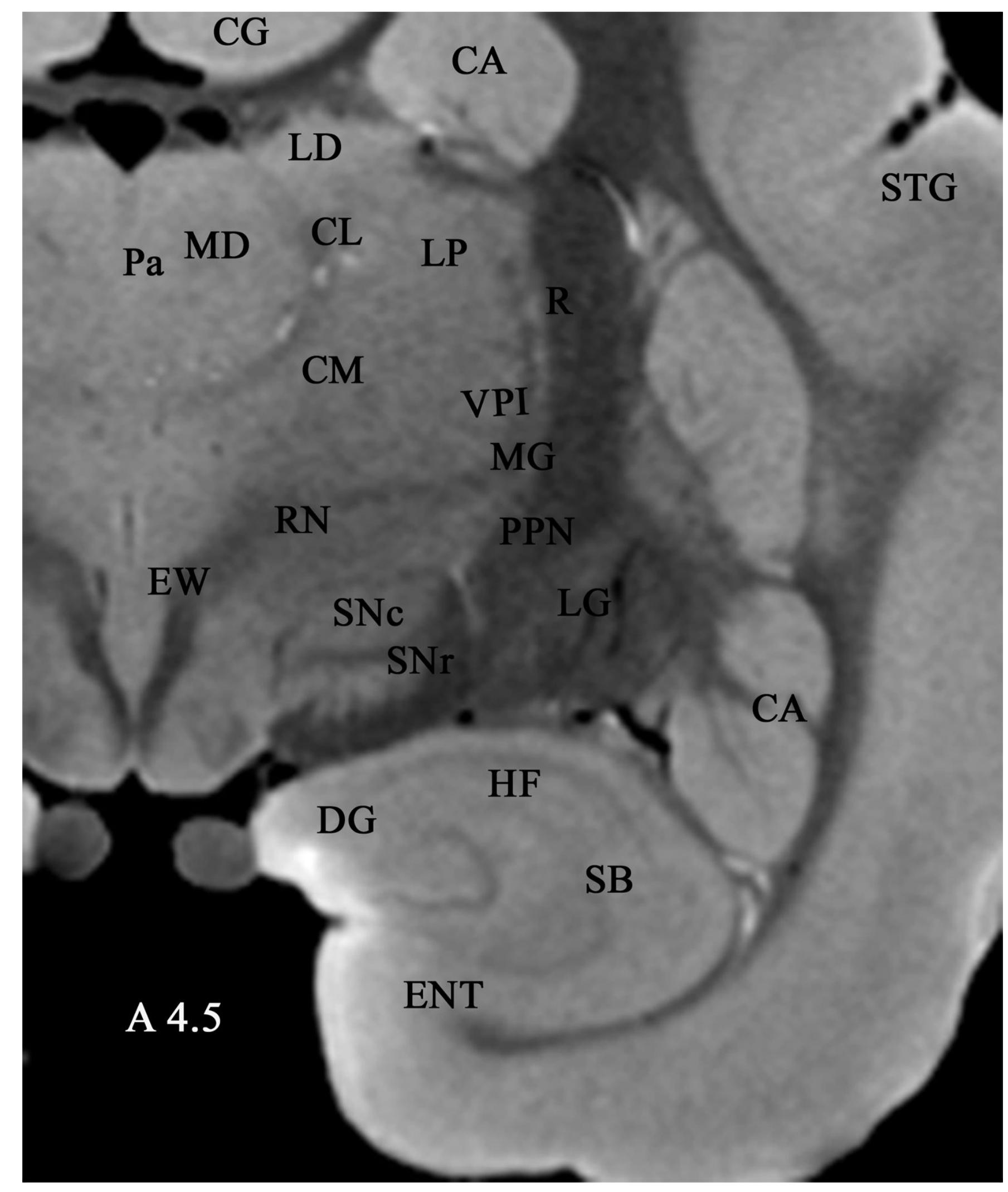Figure 47 - A combined histological and MRI brain atlas of