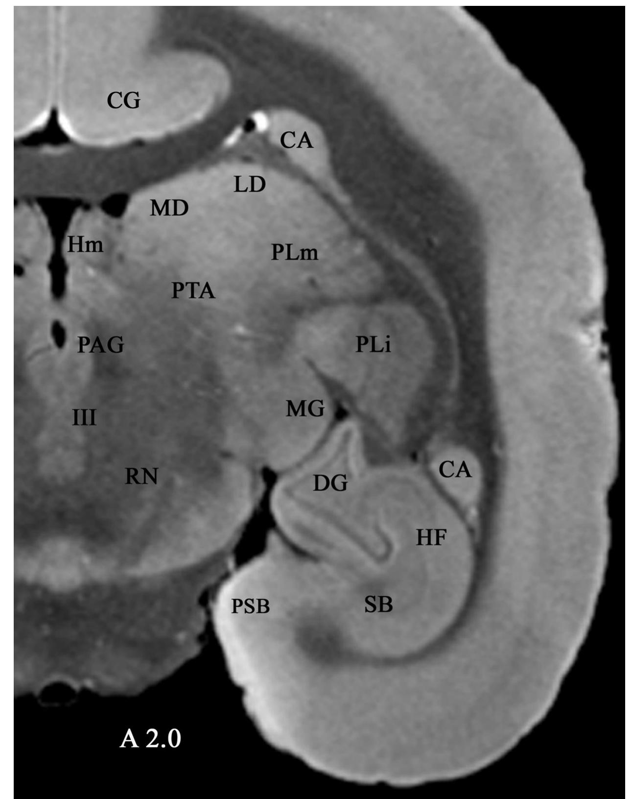 Figure 52 - A combined histological and MRI brain atlas of