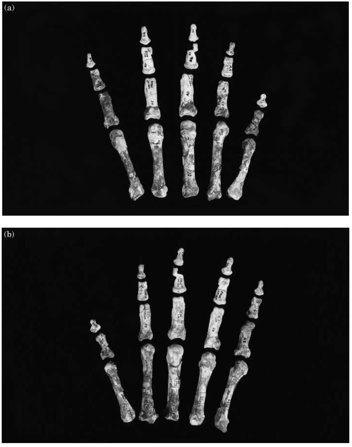 Posterior (a) and anterior (b) views of the left manus of