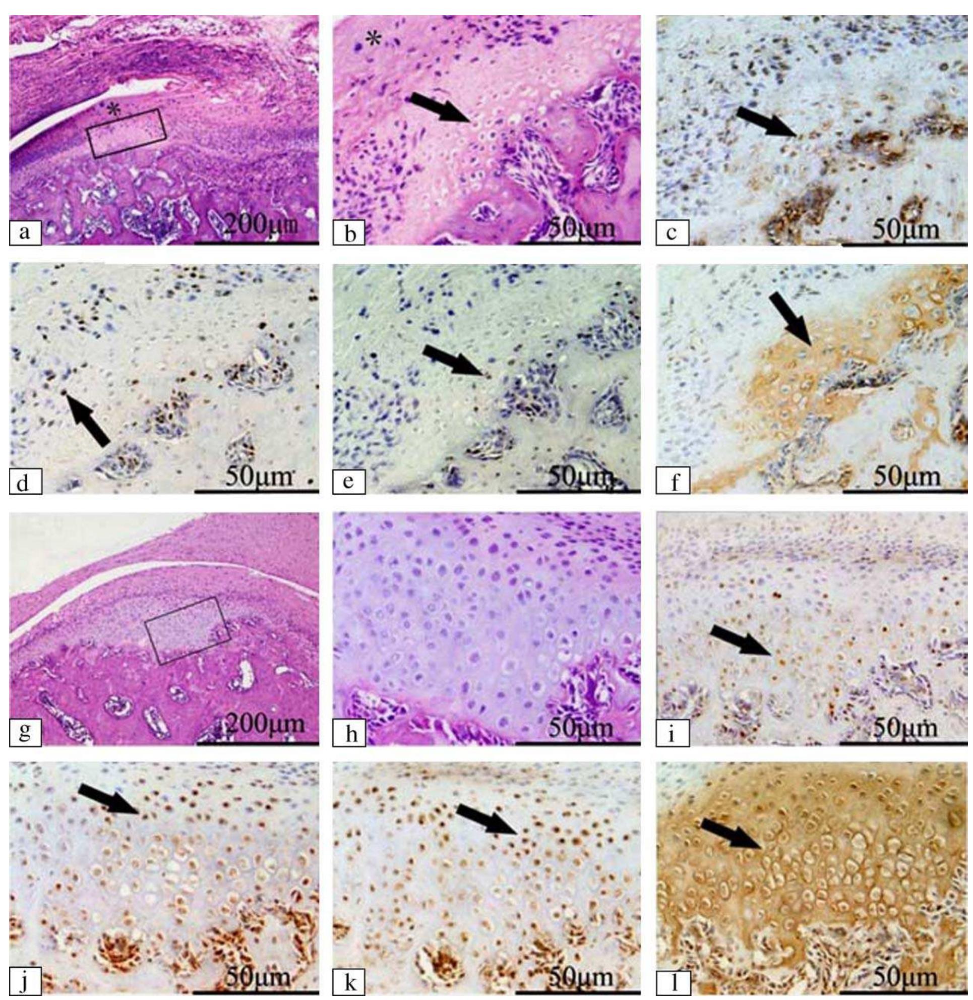 - sagittal sections of one mandibular condyle from the