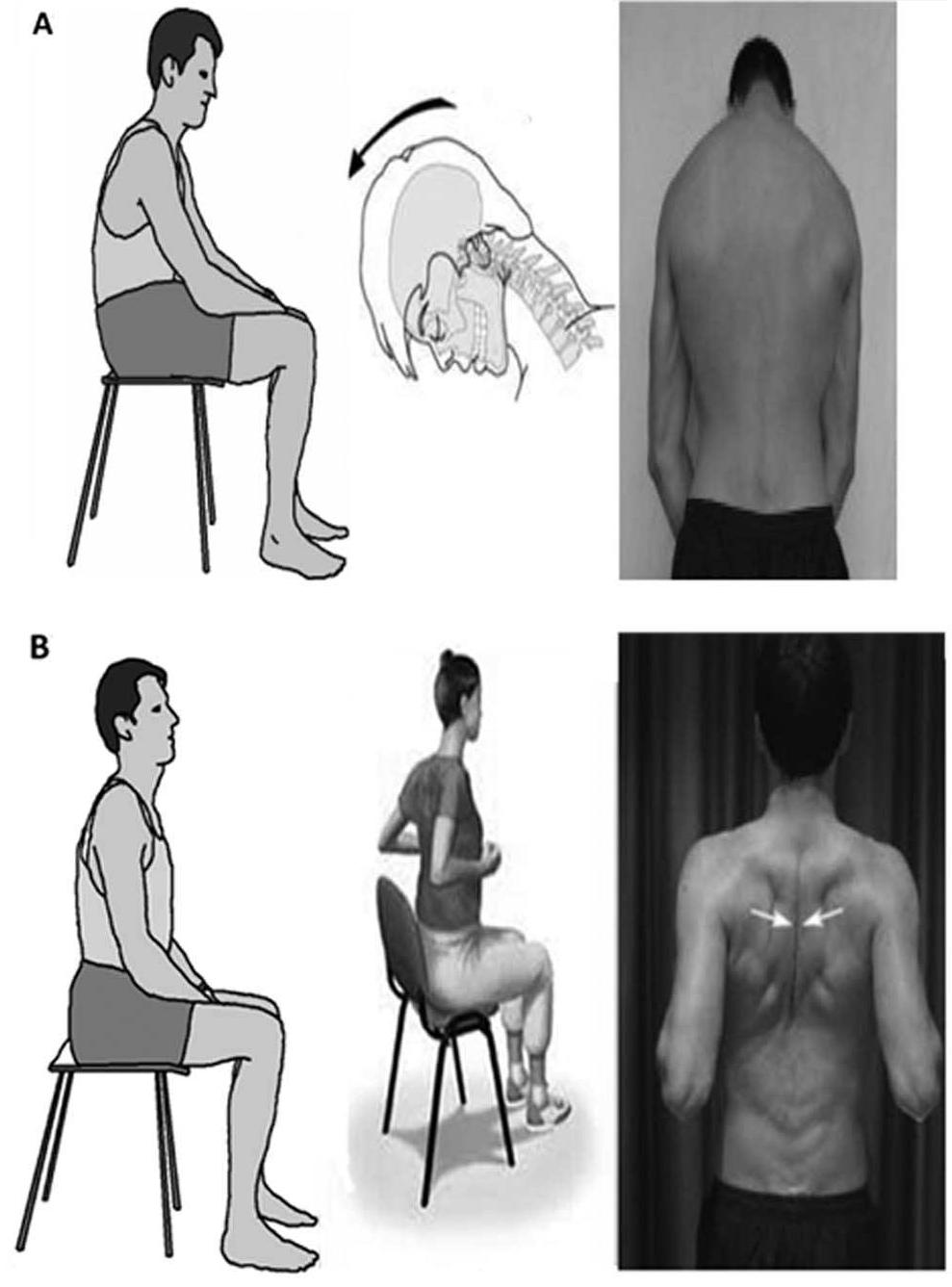 Figure 1 - from Do Slumped and Upright Postures Affect