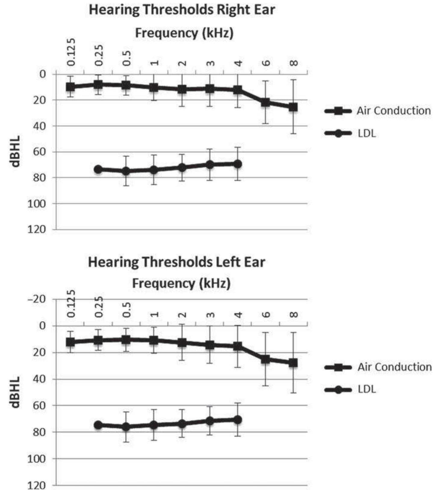 Figure 1 - from The Hyperacusis Questionnaire, loudness