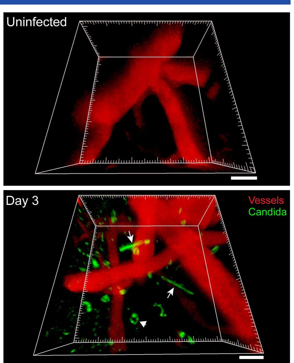 Candida albicans colonization of the brain was visualized in