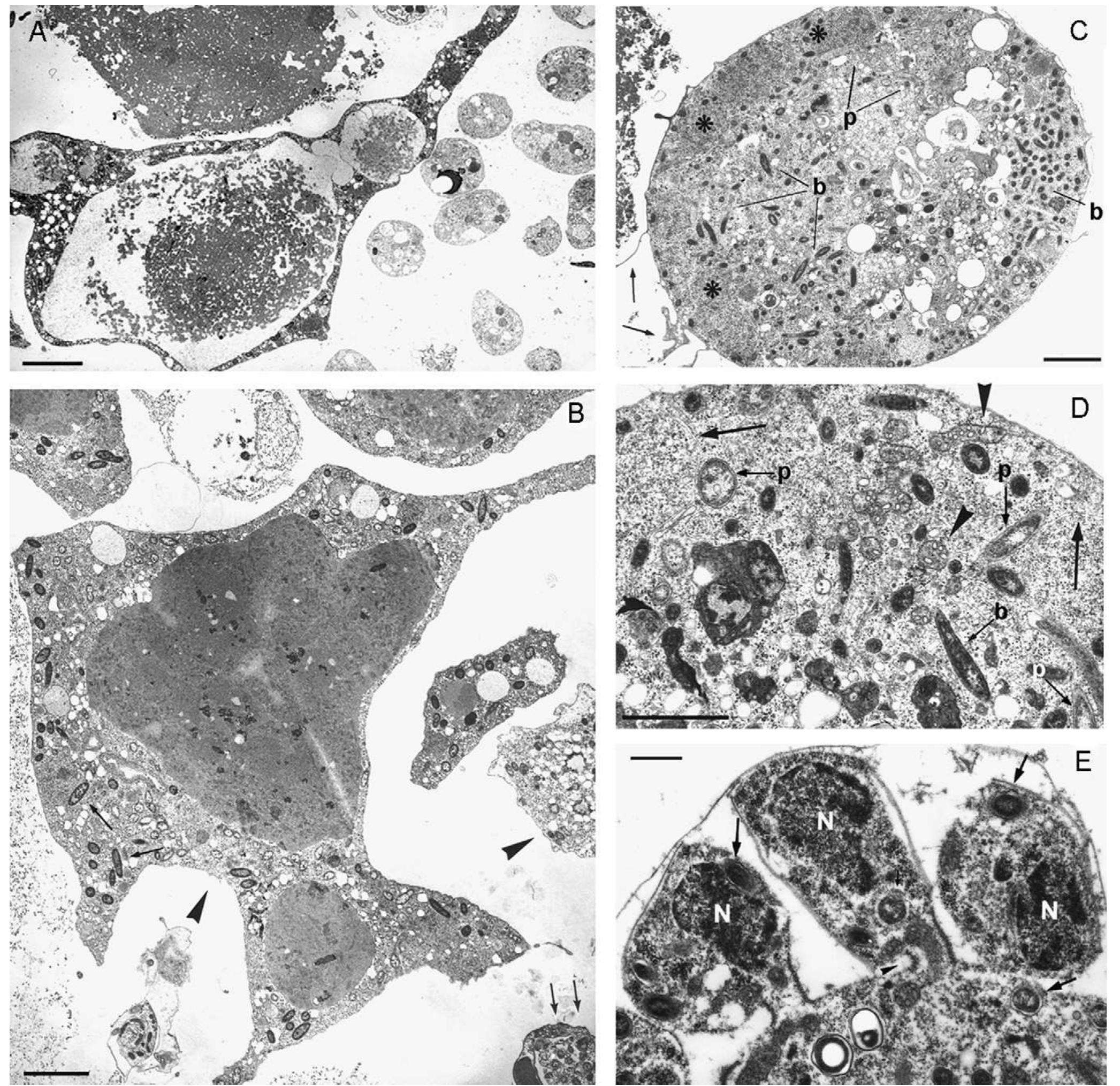 Tem images of plasmodial stages of cardiosporidium cionae