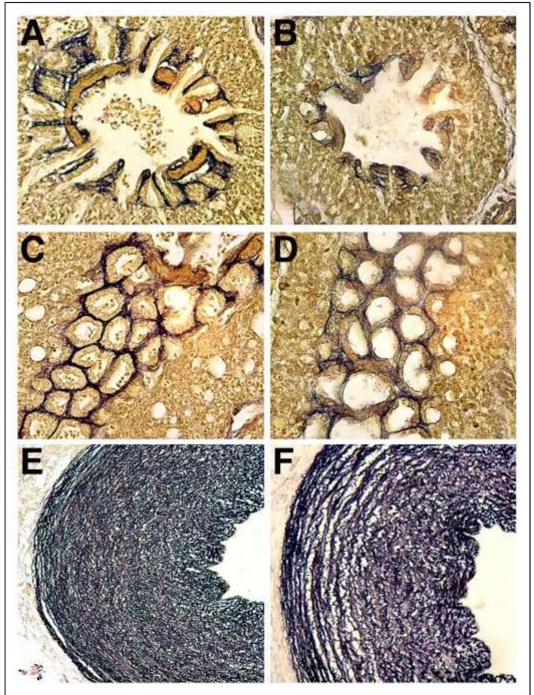 Representative micrographs of histological sections of lungs
