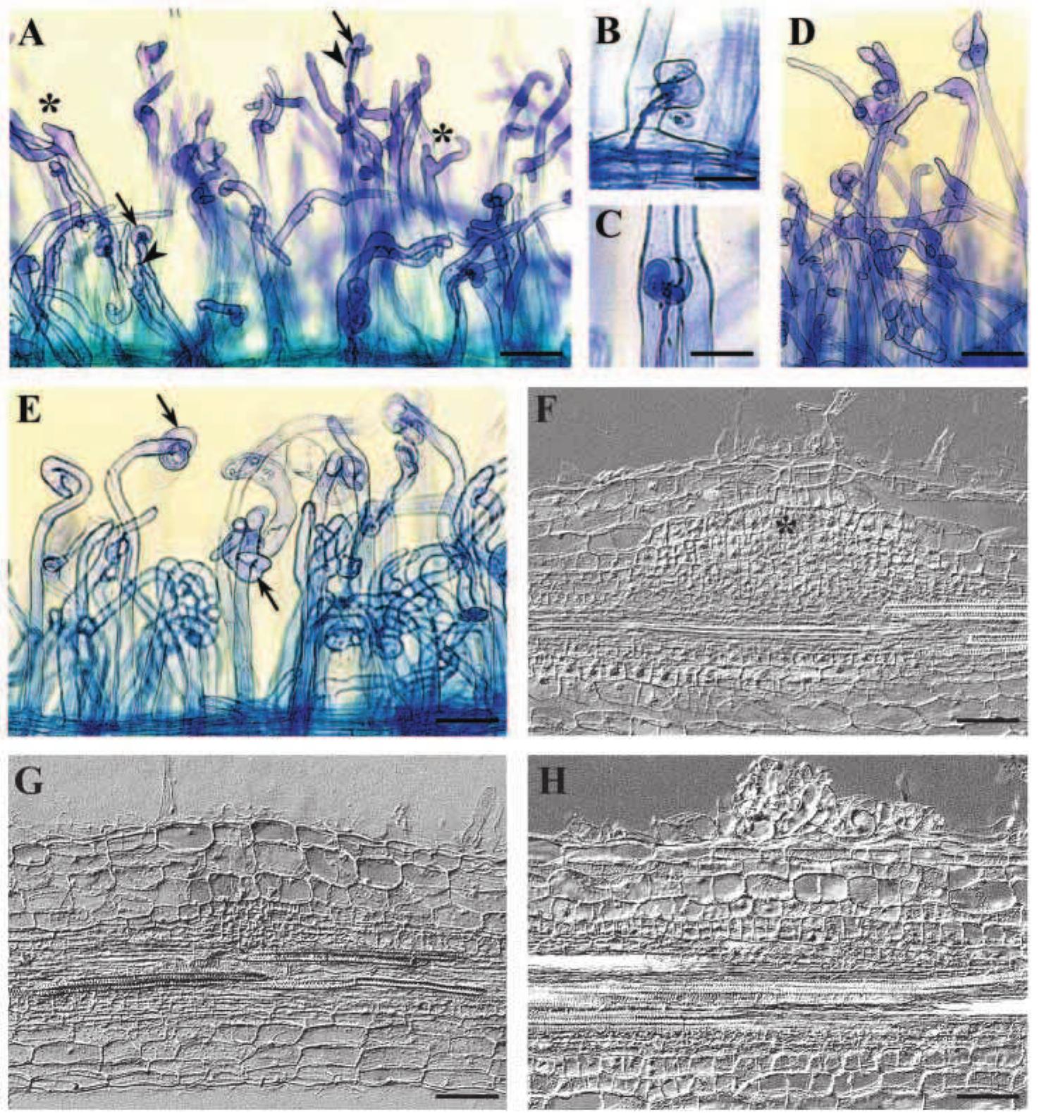 Root hair deformations and cortical cell division in