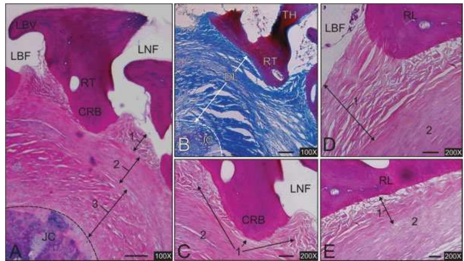 Parasagittal cross-sections of meckel’s cartilage with teeth