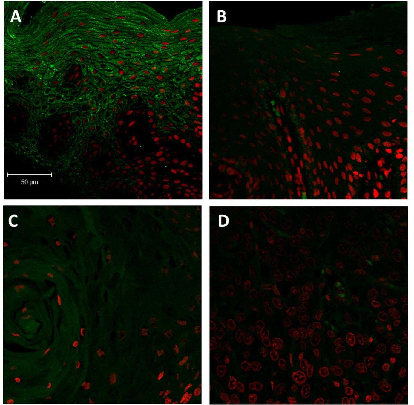 Immunofluorescence staining of k76 on human oral tissues.