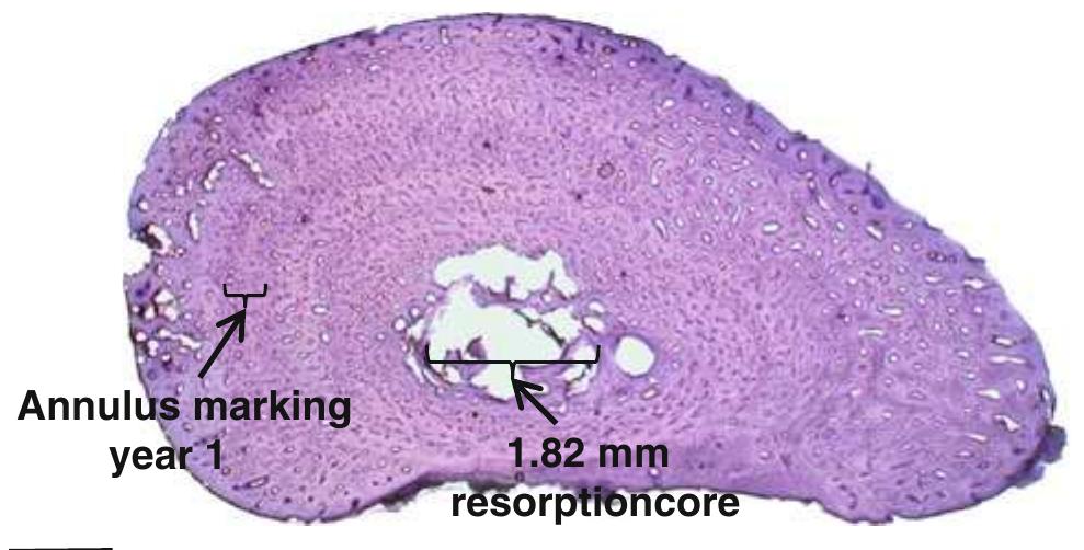 Image of a humerus cross-section from a 26.2 cm scl