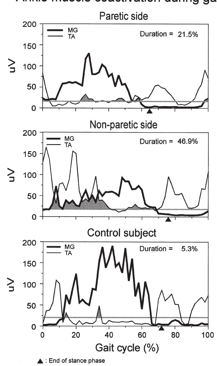 Example of coactivation calculation for the entire gait