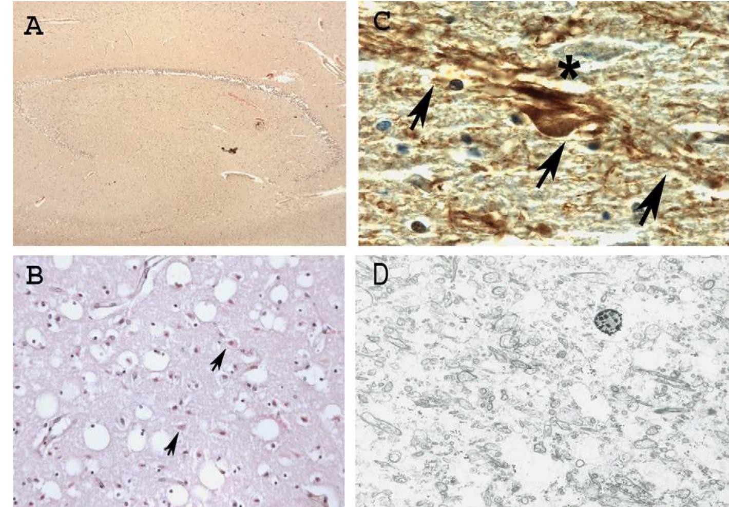 (a) hematoxylin and eosin staining of dentate gyrus (right