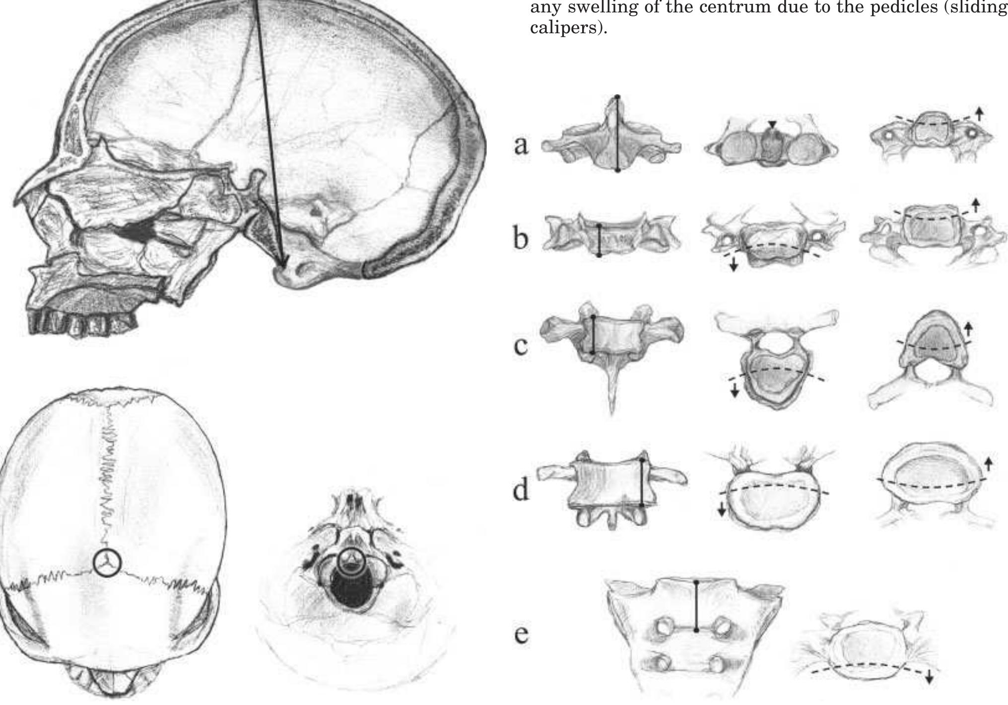 Vertebral measurements. fig. 3. cranial height measurement.