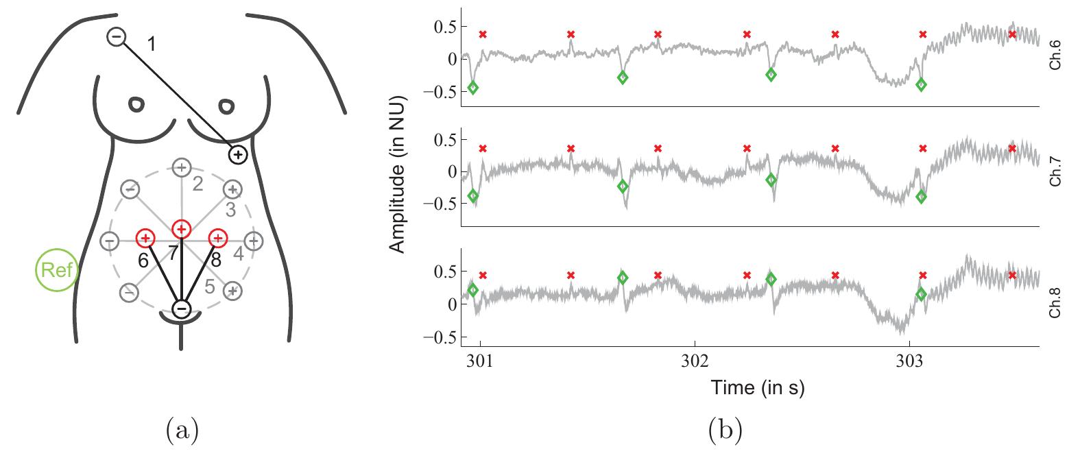 (a) electrode configuration for patient recording. three