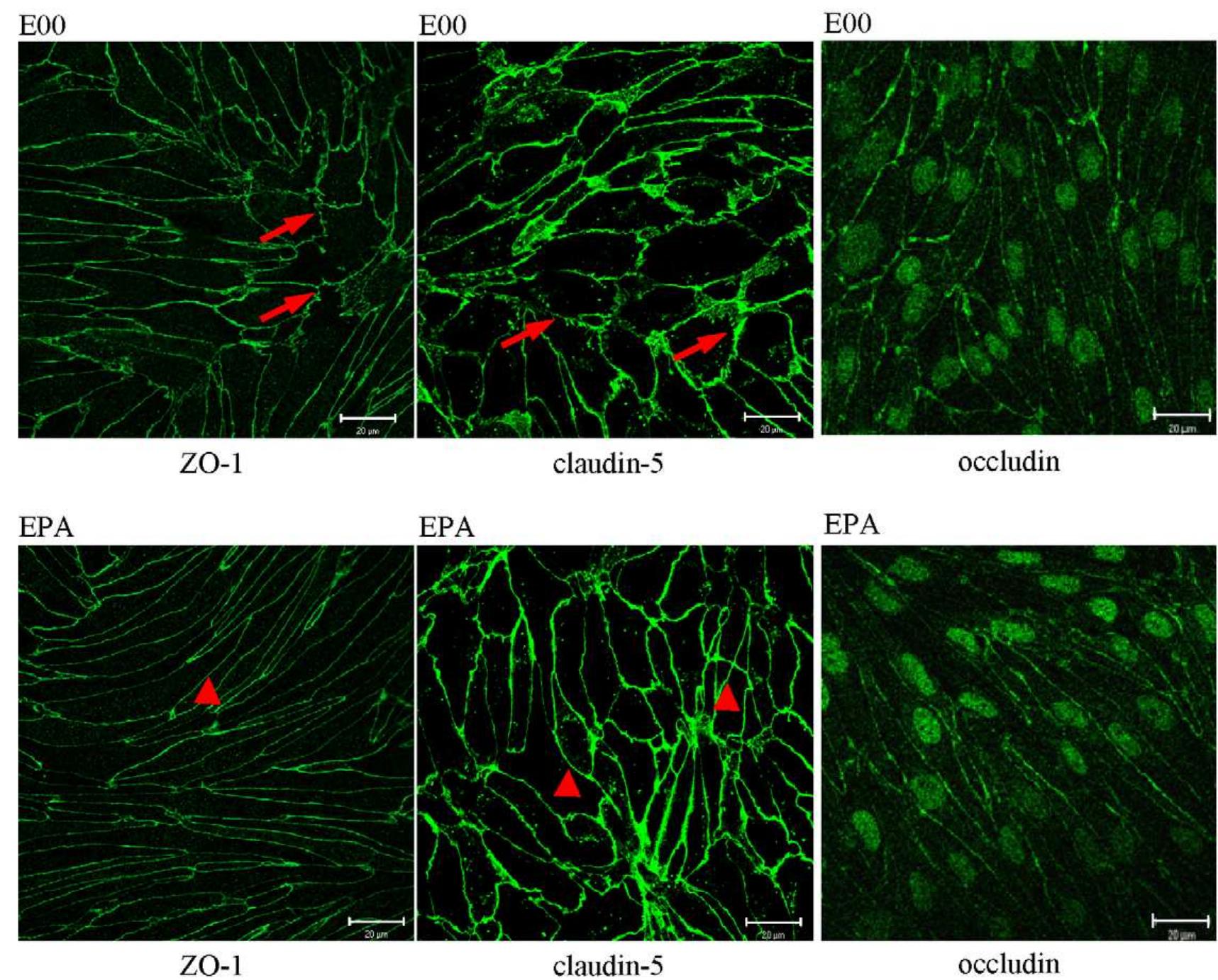 Immunofluorescent staining of confluent brain endothelial