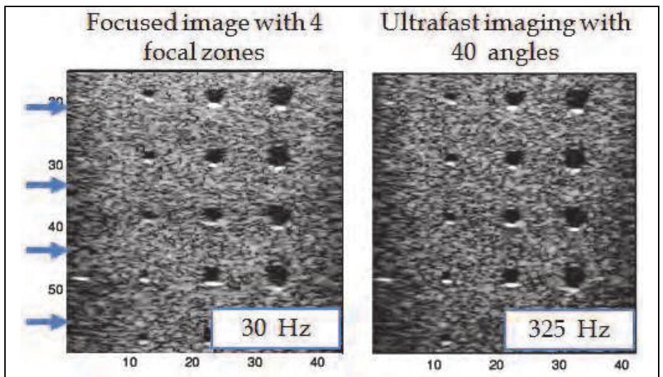 3.1.1 shear waves in soft tissues two types of mechanical