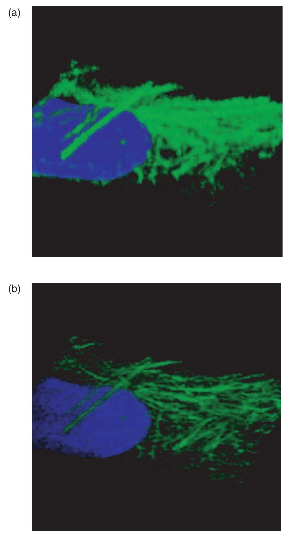Confocal and 4pi image. comparison of volume rendered images