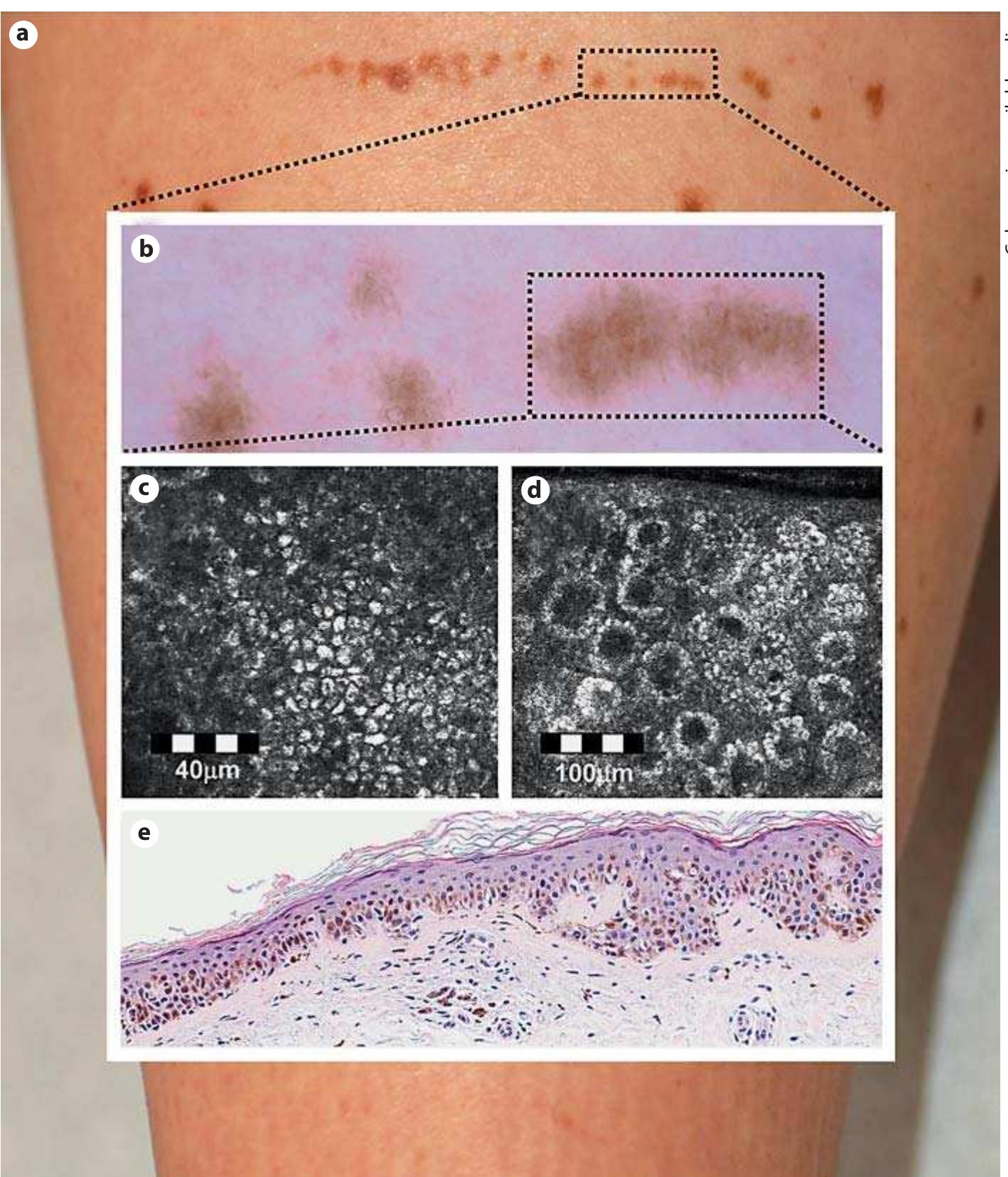 Hair follicle, the interfollicular epidermis and possibly