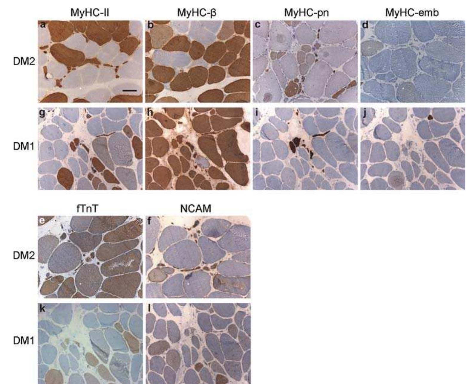 Immunohistochemistry of representative dm2 and dmi muscle