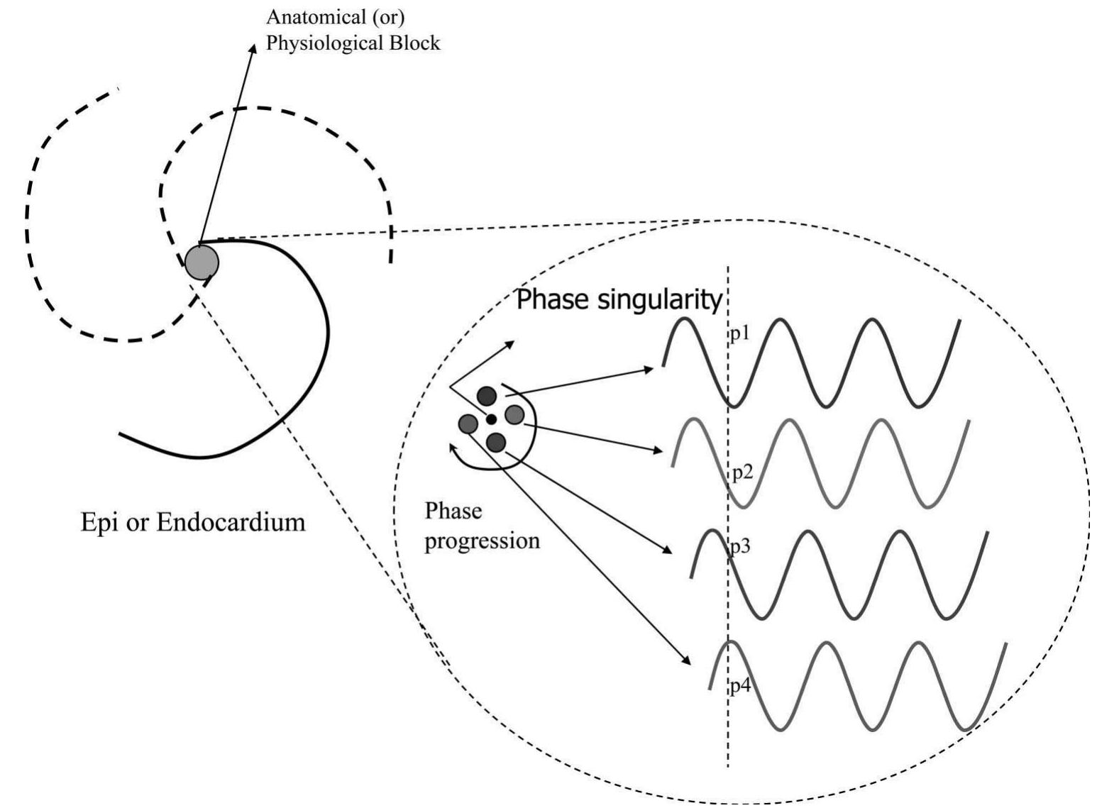 Phase singularity concept using a conduction block and a
