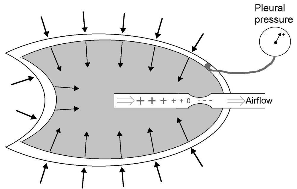 Cartoon of chest during forced expiration. pleural pressure