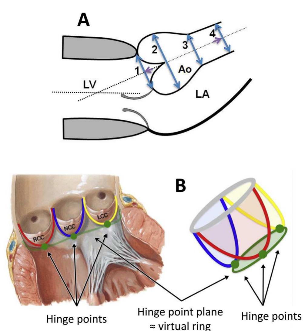 (a) sites for measurements of the aortic root and ascending