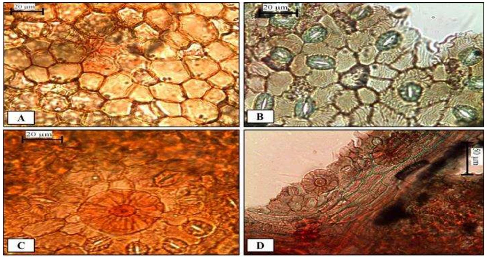 Surface preparation of the leaflet; a: upper epidermis, b: