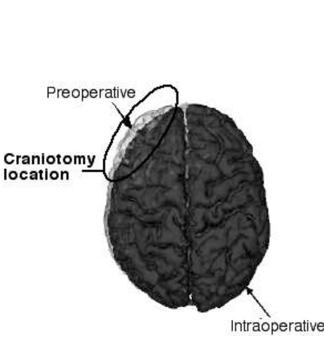 Comparison of the brain surface determined from images