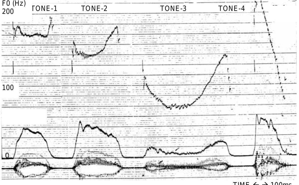 Tone-2; rising, tone-3; low flat followed by rising, and