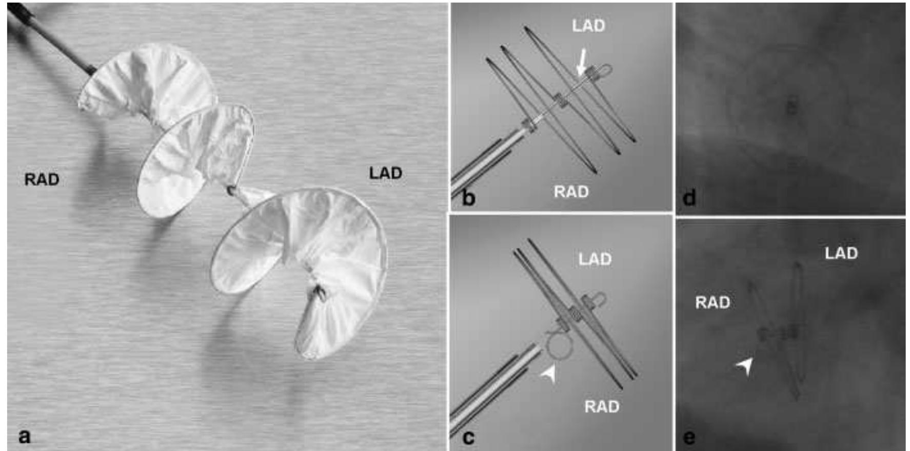 (a) photograph of an extended helex. (b) diagram of a