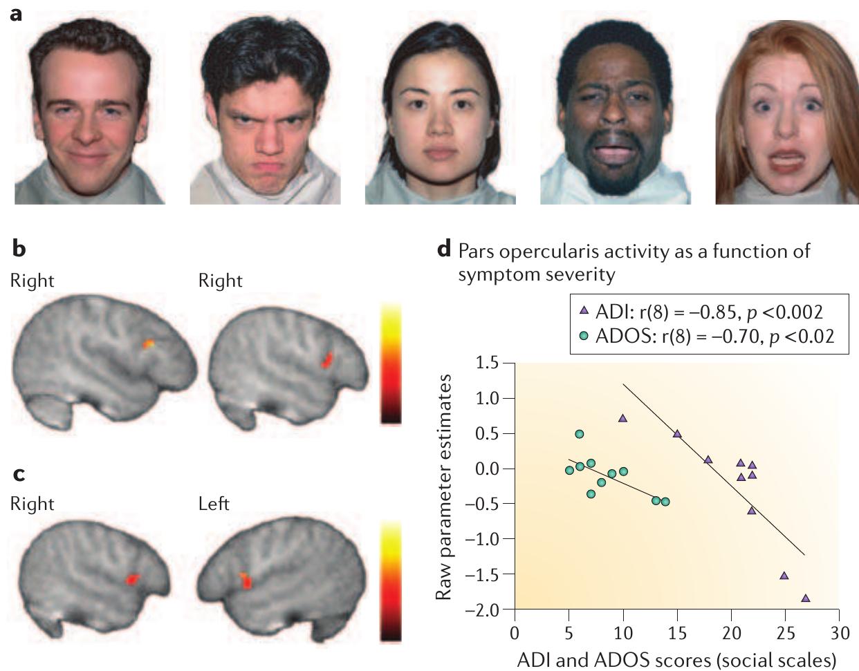 ‘igure 5 | the human mirror neuron system and autism.