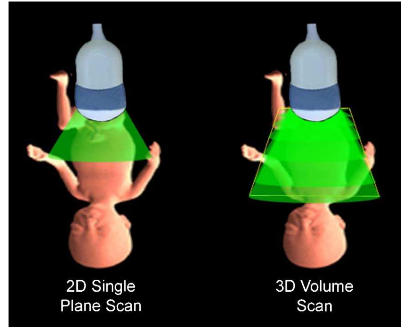 This illustrates a comparison between a single 2d image