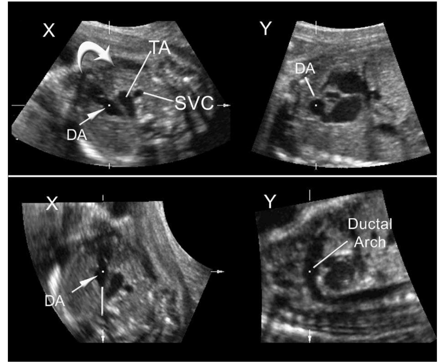 The upper panel illustrates a transverse plane through the