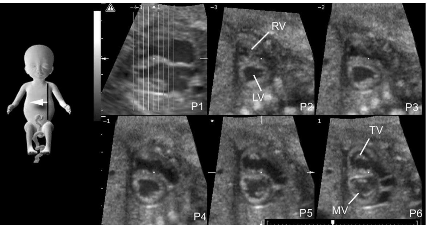This demonstrates a sagittal sweep using either the static