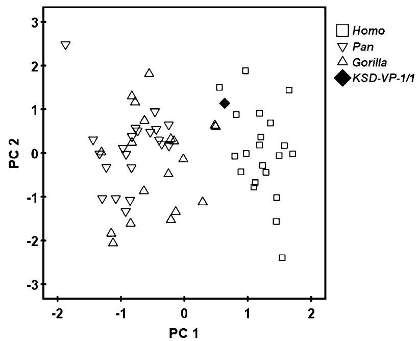 Pca of scapular angular data. pc7 for five scapular angles