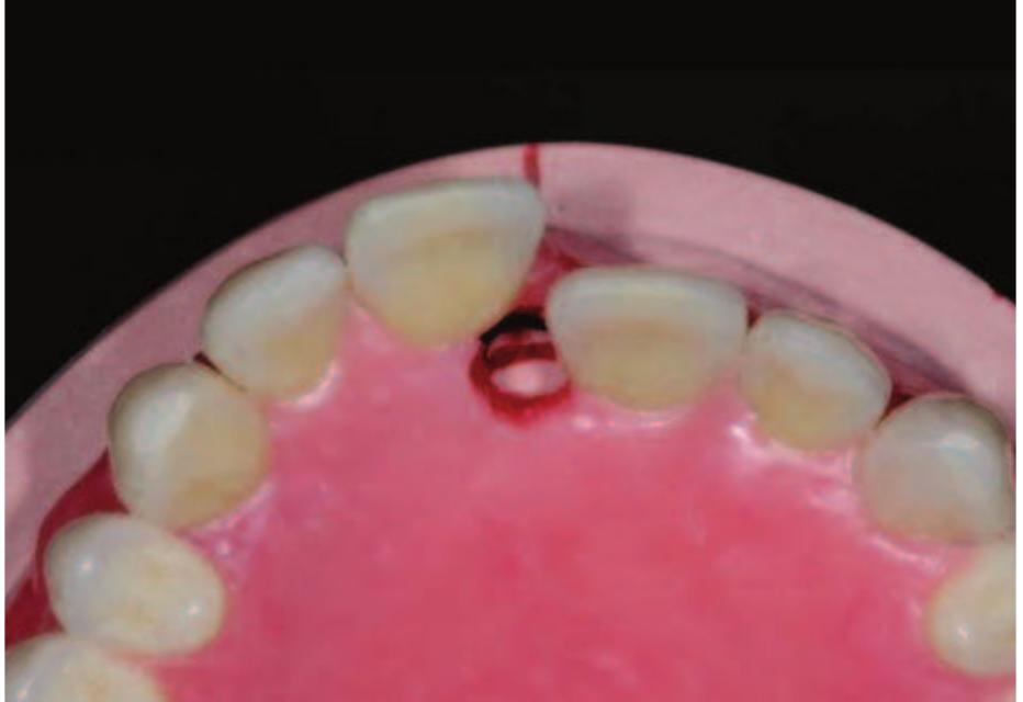 Anterior tooth position.