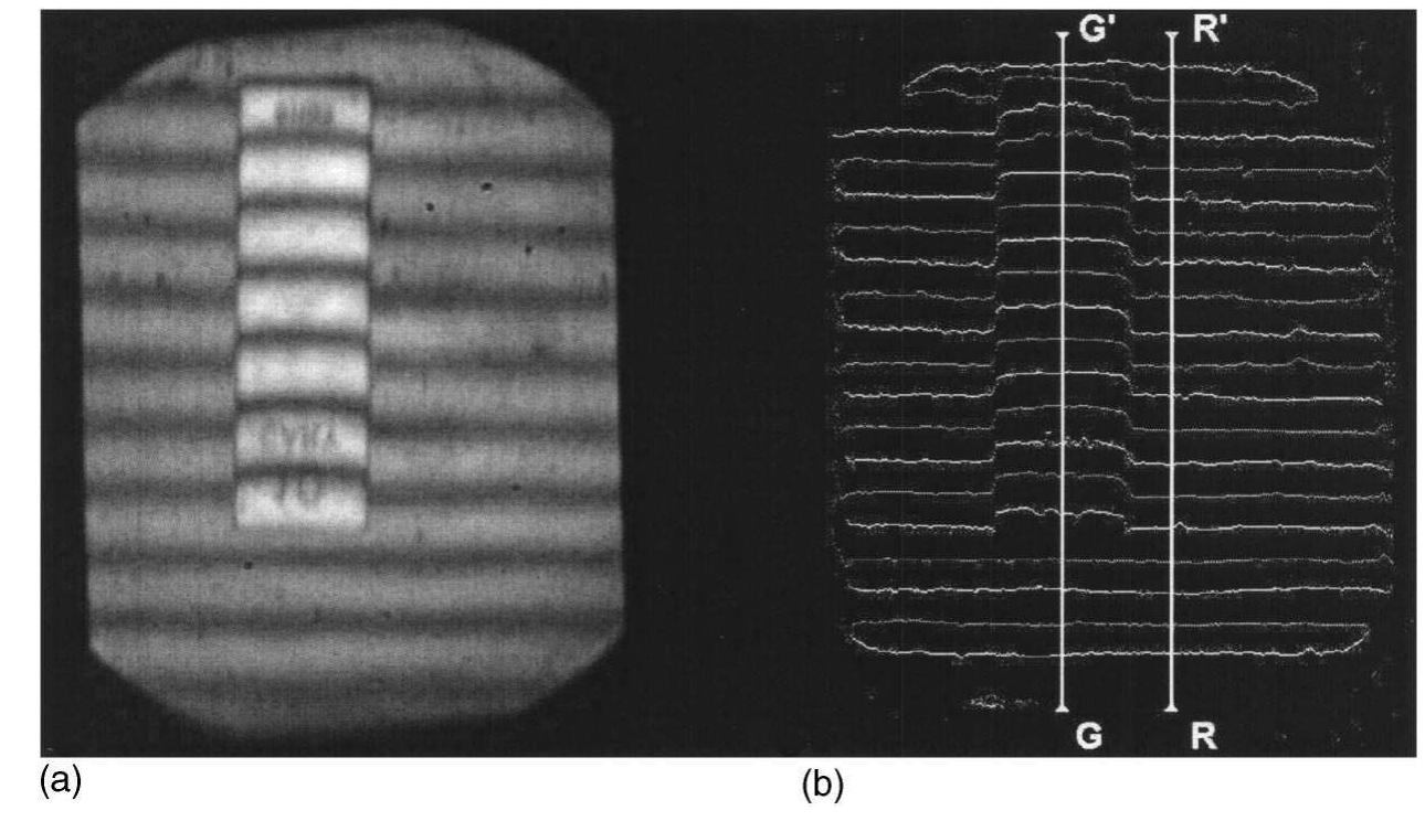 (a) enhanced and (b) skeletal images.