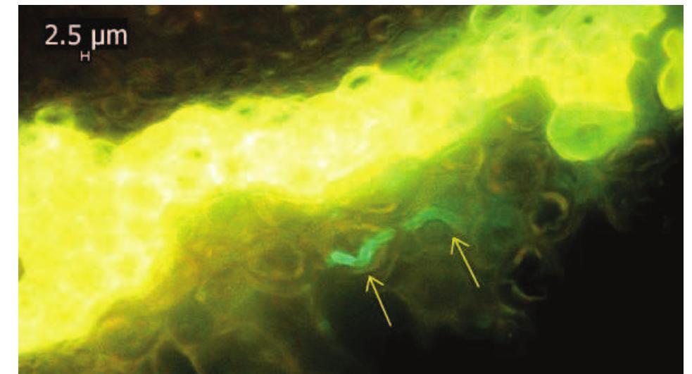Figure 4 - Histology of Phytophthora ramorum in