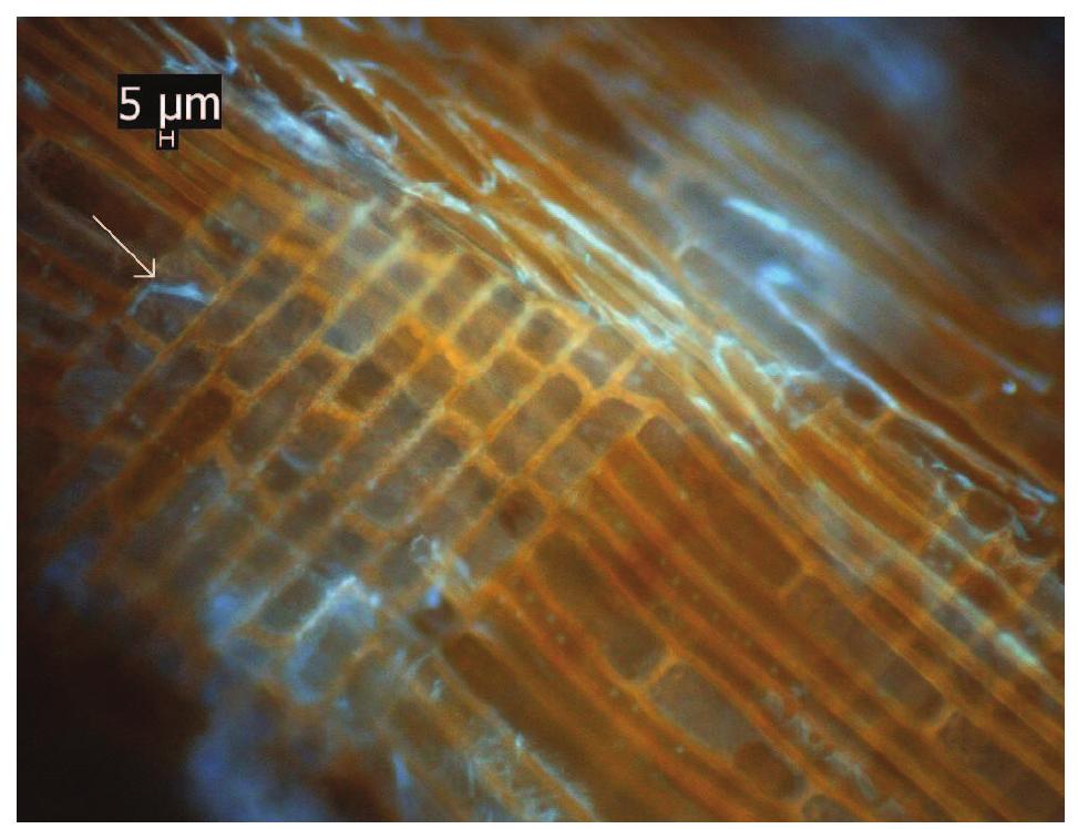 Igure 10: hypha in a xylem ray (arrow). fluorescence
