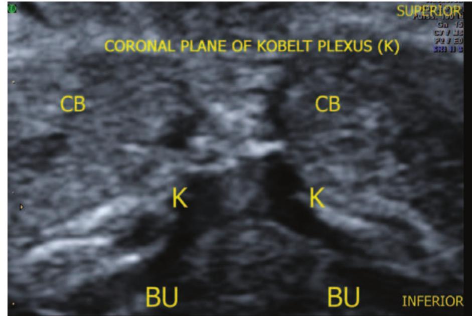 Two-dimensional coronal plane of venous kobelt plexus that