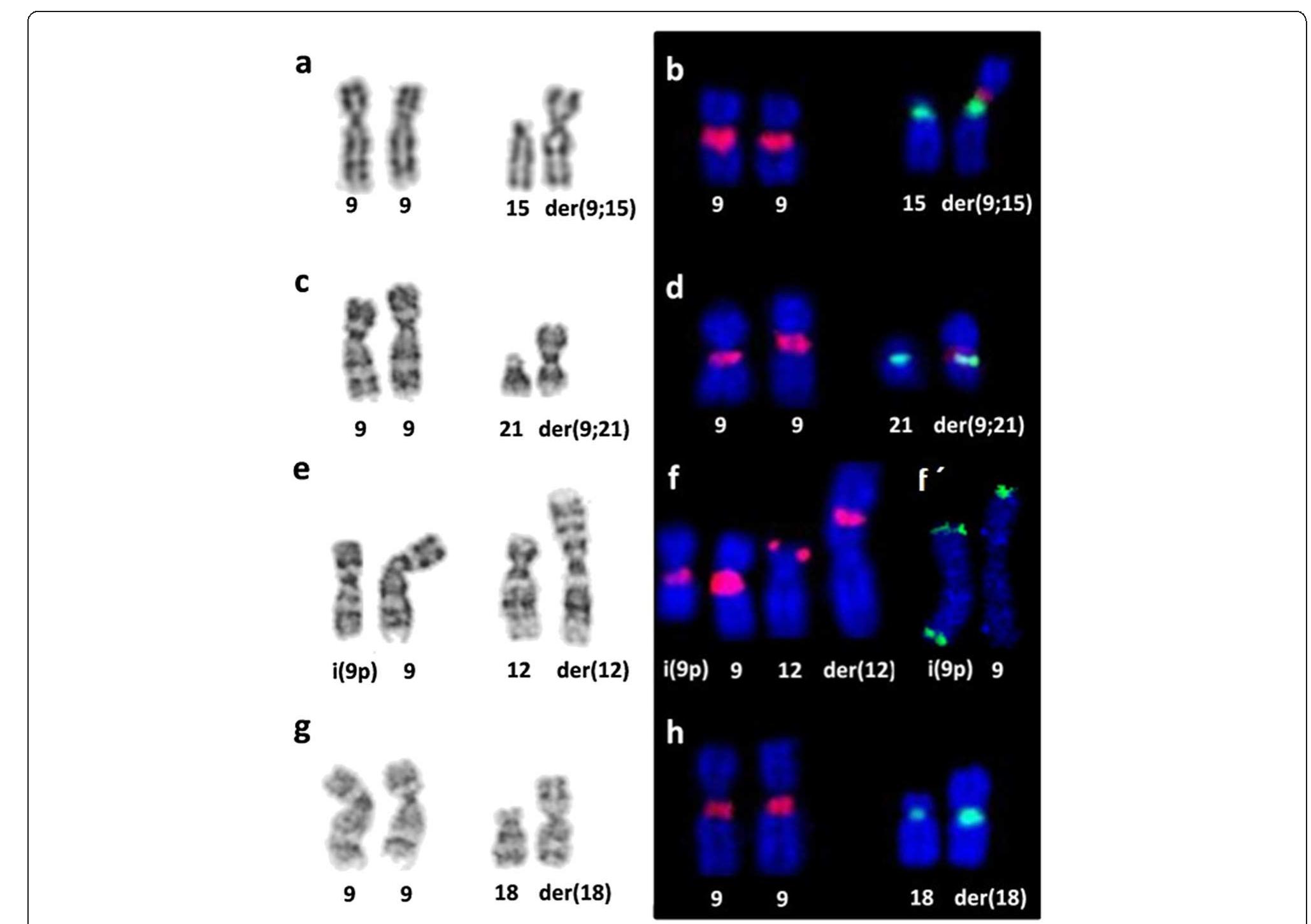 Partial g-banding karyotype and fish results in chromosomes